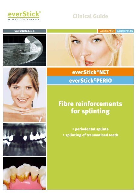 Fibre reinforcements for splinting - StickTech