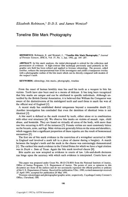 Toneline Bite Mark Photography - Library