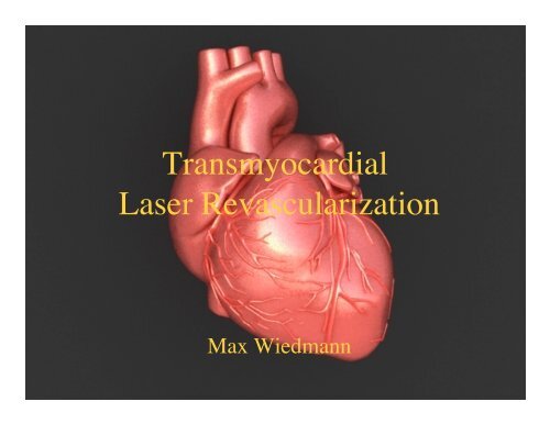 Transmyocardial Laser Revascularization