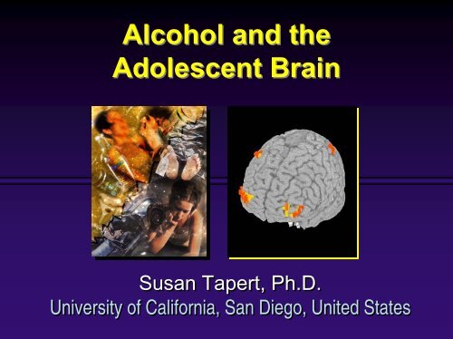 Alcohol and the Adolescent Brain Alcohol and the Adolescent Brain