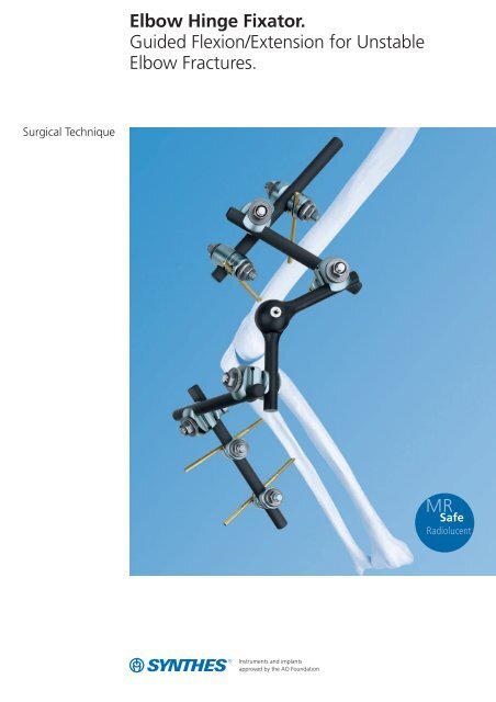 MR Elbow Hinge Fixator. Guided Flexion/Extension for ... - Synthes