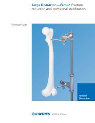 Synthes-Large distractor tibia.pdf