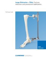 VariAx™ Distal Radius Locking Plate System