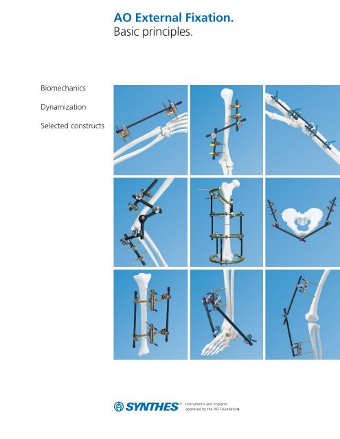 AO External Fixation Basic Principles (PDF)
