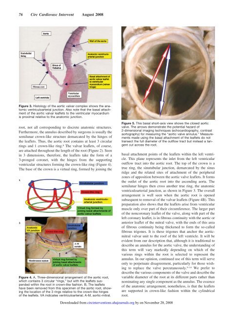 76 Circ Cardiovasc Interv