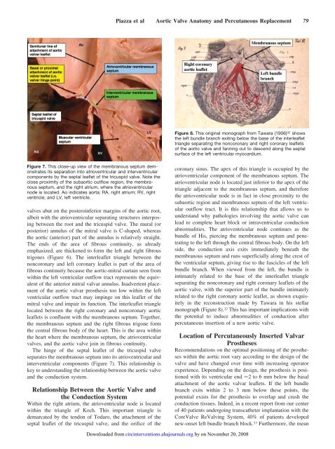 78 Circ Cardiovasc Interv