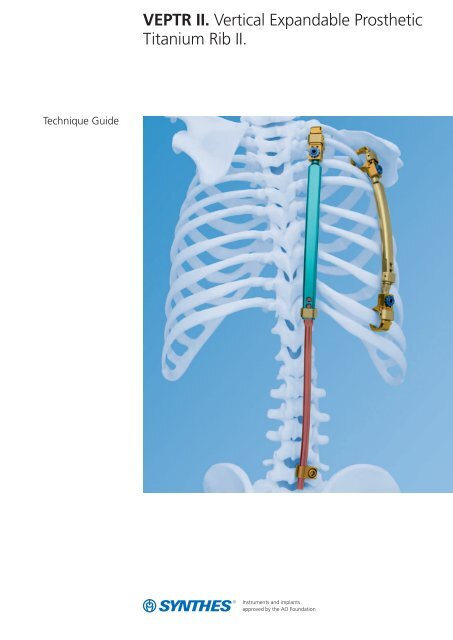VEPTR II. Vertical Expandable Prosthetic Titanium Rib II. - Synthes