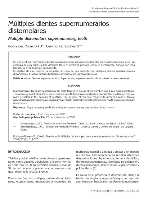 Múltiples dientes supernumerarios distomolares