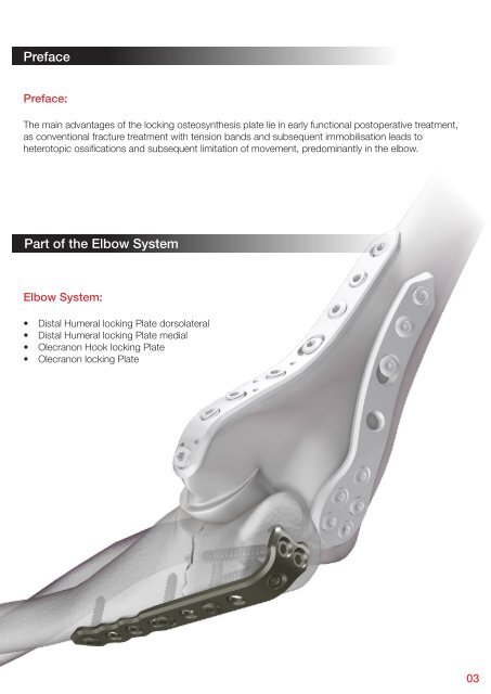 OHL OLECRANON HOOK LOCKING PLATE - ITS-Implant.com