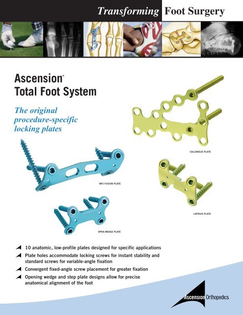Ascension® Total Foot System - Extremity Reconstruction