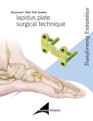Ascension® Total Foot System - Extremity Reconstruction