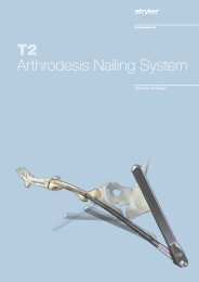 T2 Ankle Arthrodesis Operative Technique - Stryker