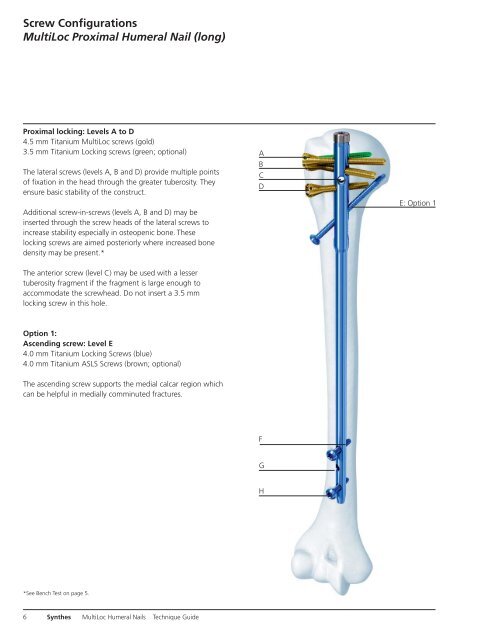 MultiLoc Humeral Nails. Humeral nails with multiple ... - Synthes