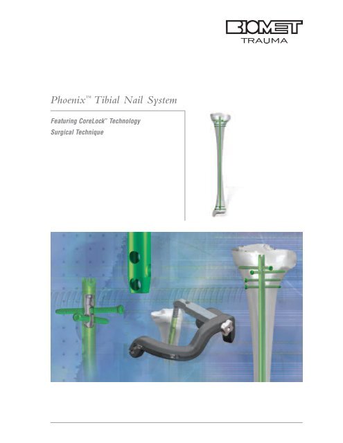 Phoenix™ Tibial Nail System - Biomet