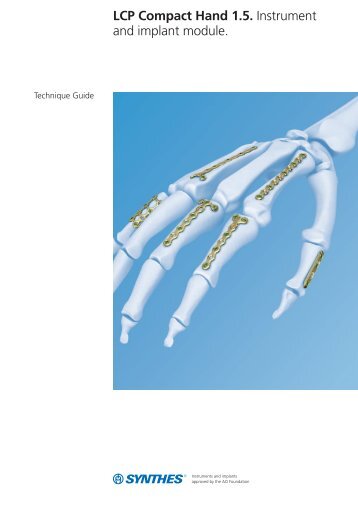 LCP Superiore Anteriore Klavikulaplatte. Das anatomisch ... - Synthes
