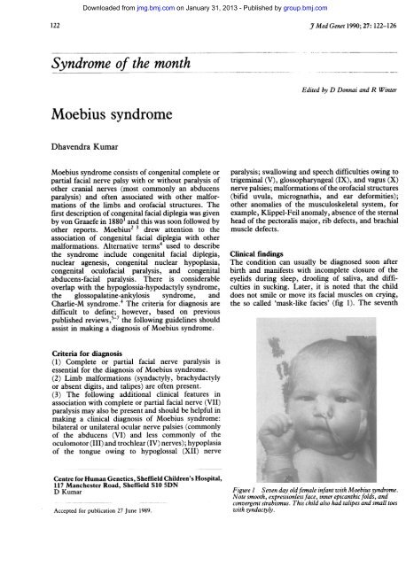 Syndrome of the month Moebius syndrome