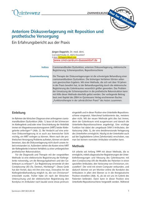 Behandlung Der Diskusverlagerung Nach Vorne Mit Reposition – QSEQNN