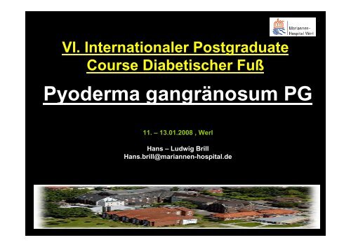 Pyoderma gangränosum PG
