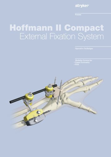 Dynamic Joint Distractor II External Fixation System - Stryker