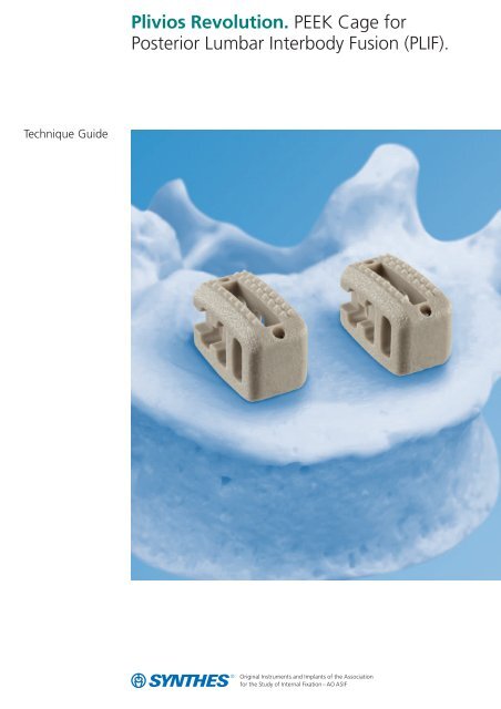Plivios Revolution. PEEK Cage for Posterior Lumbar Interbody ...