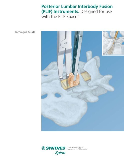 Posterior Lumbar Interbody Fusion (PLIF) Instruments ... - Synthes