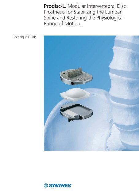 Prodisc-L. Modular Intervertebral Disc Prosthesis for ... - Synthes Prodisc-L. Modular Intervertebral Disc Prosthesis for ... - Synthes