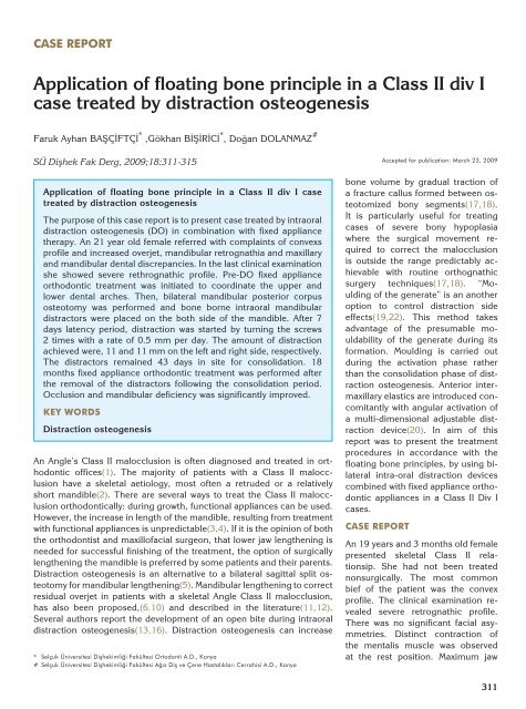 Application of floating bone principle in a Class II div I case treated ...