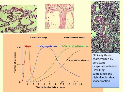 Clinically this is charac